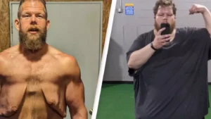 Man who lost 400 pounds is trying to raise $100K to remove excess skin ...